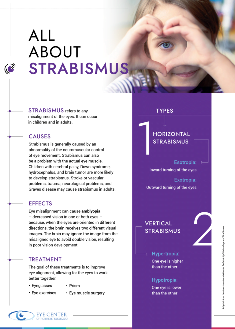 Check out the blog on All About Strabismus